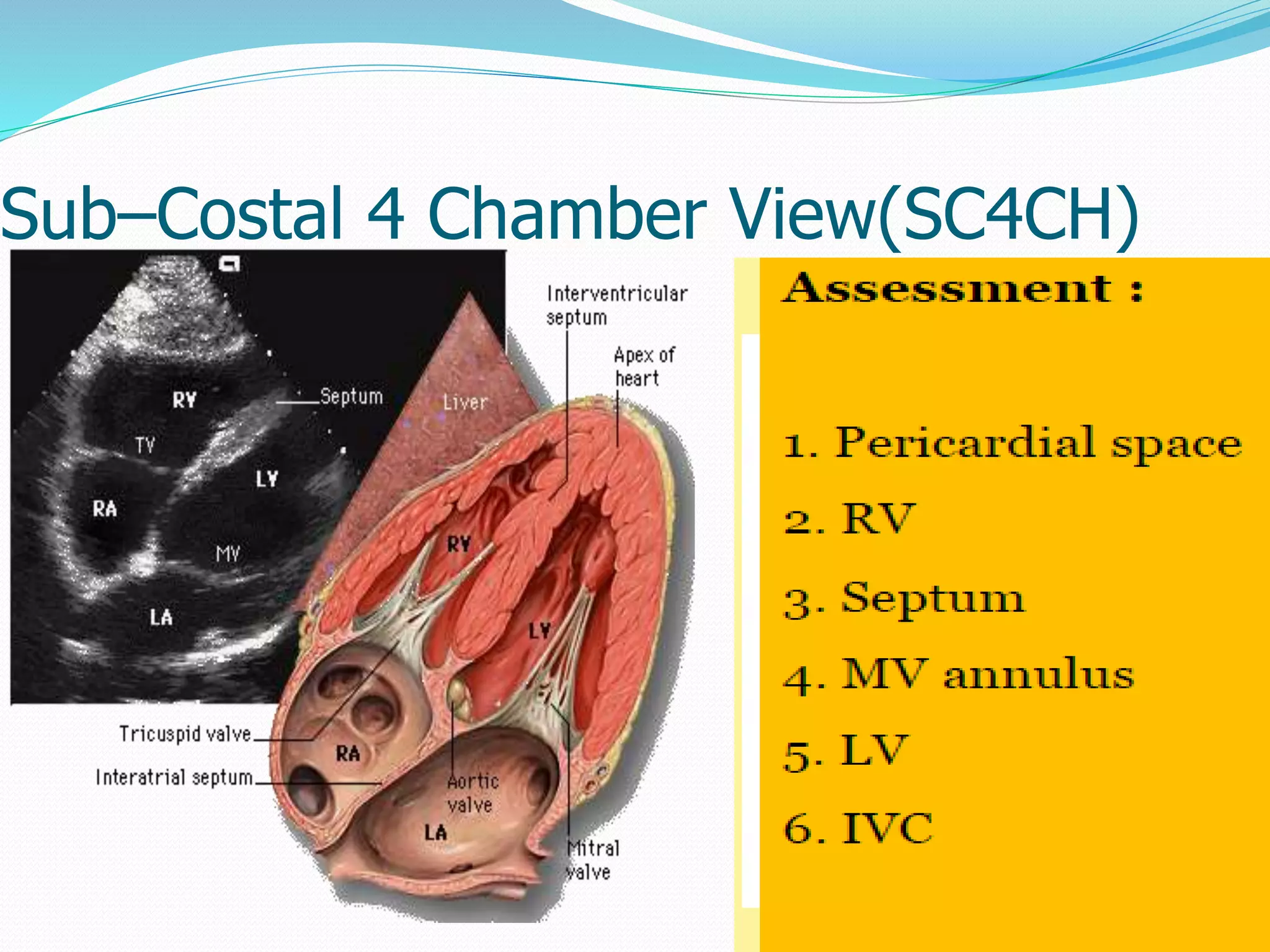 Basic echocardiography | PPTX
