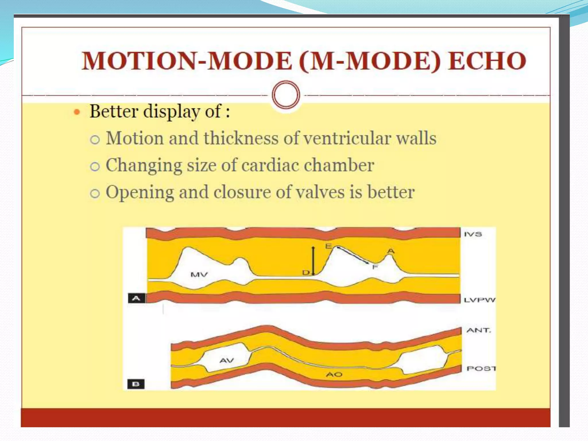 Basic echocardiography | PPTX