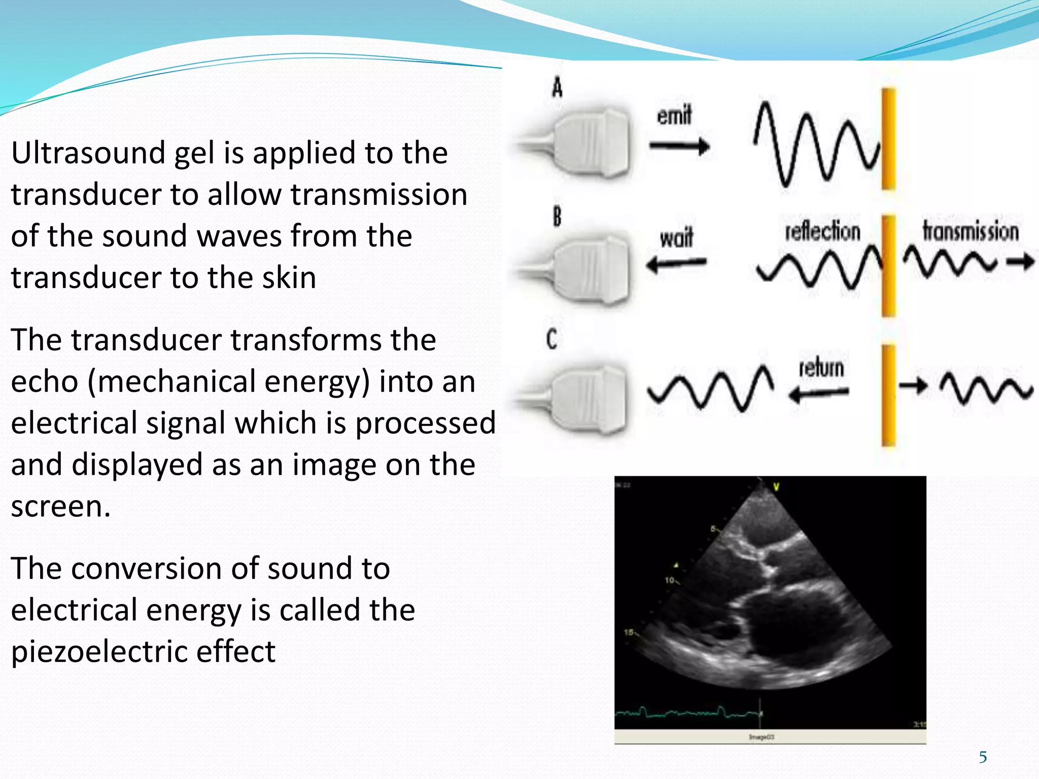 Basic echocardiography | PPTX