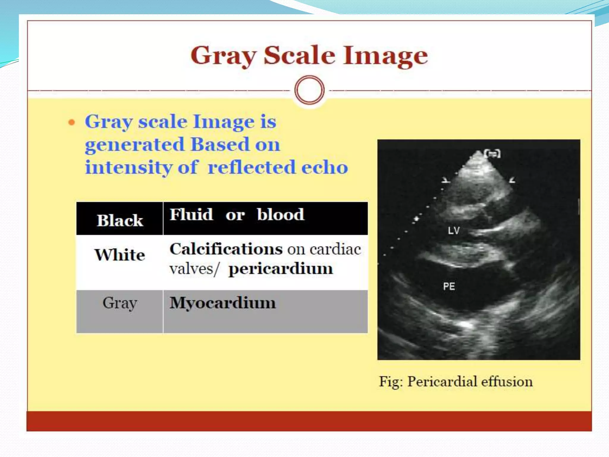 Basic echocardiography | PPTX