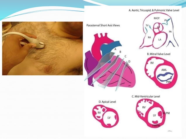Basic echocardiography | PPTX