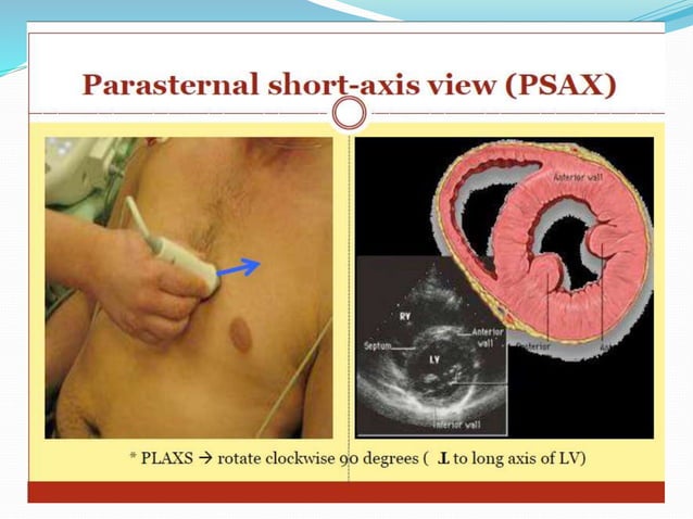 Basic echocardiography | PPTX