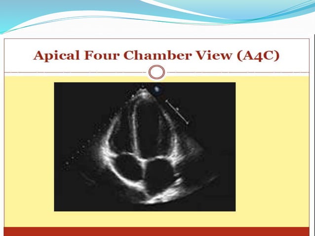 Basic echocardiography | PPTX