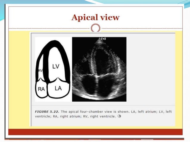 Basic echocardiography | PPTX