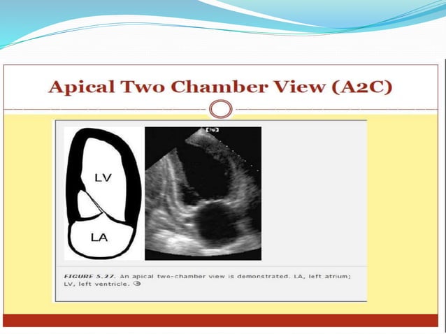 Basic echocardiography | PPTX