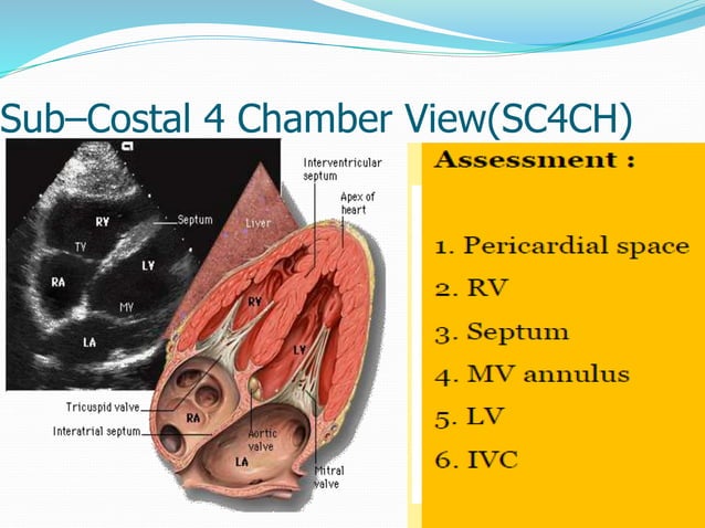 Basic echocardiography | PPTX