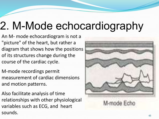 Basic echocardiography | PPTX