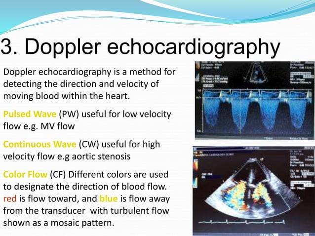 Basic echocardiography | PPTX