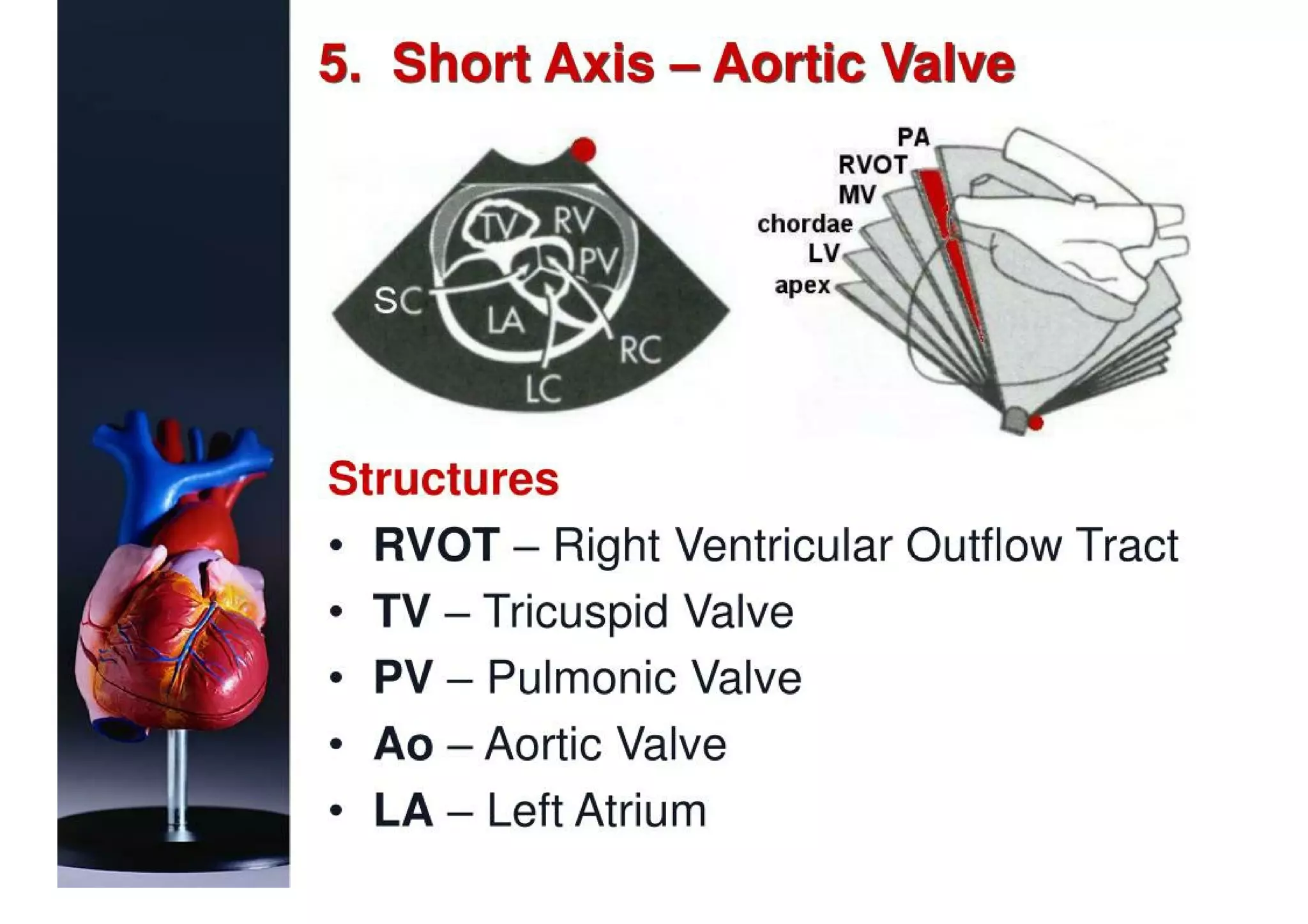 Basic Echocardiography | PDF