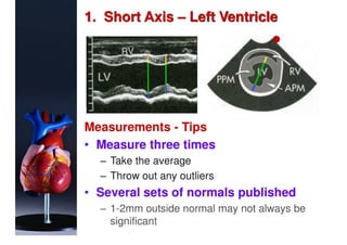 Basic Echocardiography | PPT