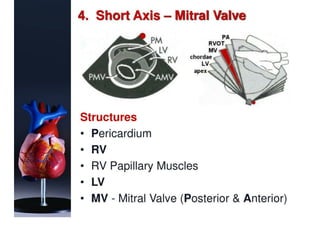 Basic Echocardiography | PPT