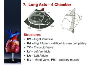 Basic Echocardiography | PPT