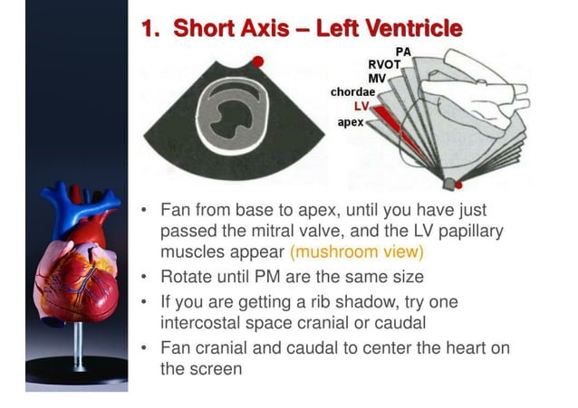 Basic Echocardiography | PPT