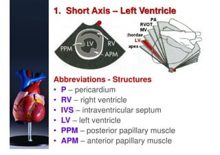 Basic Echocardiography | PPT