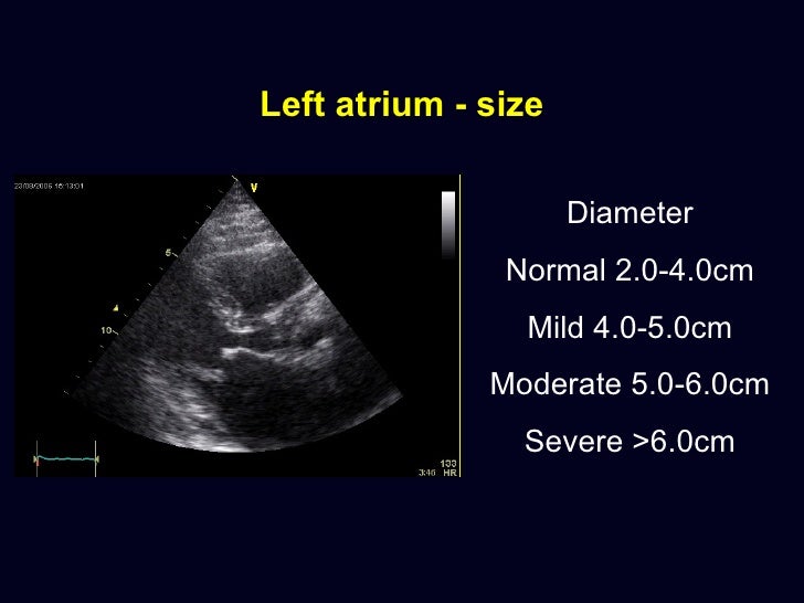Basic Ecocardiography