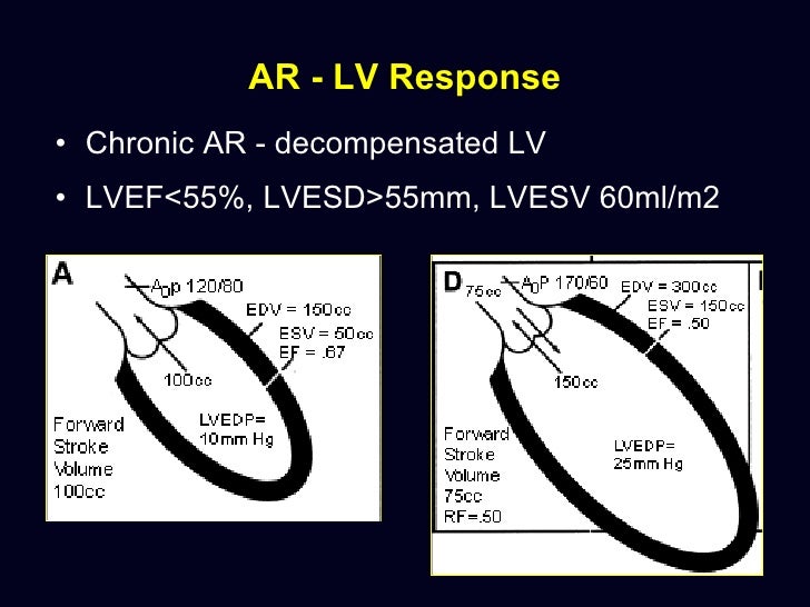Basic Ecocardiography