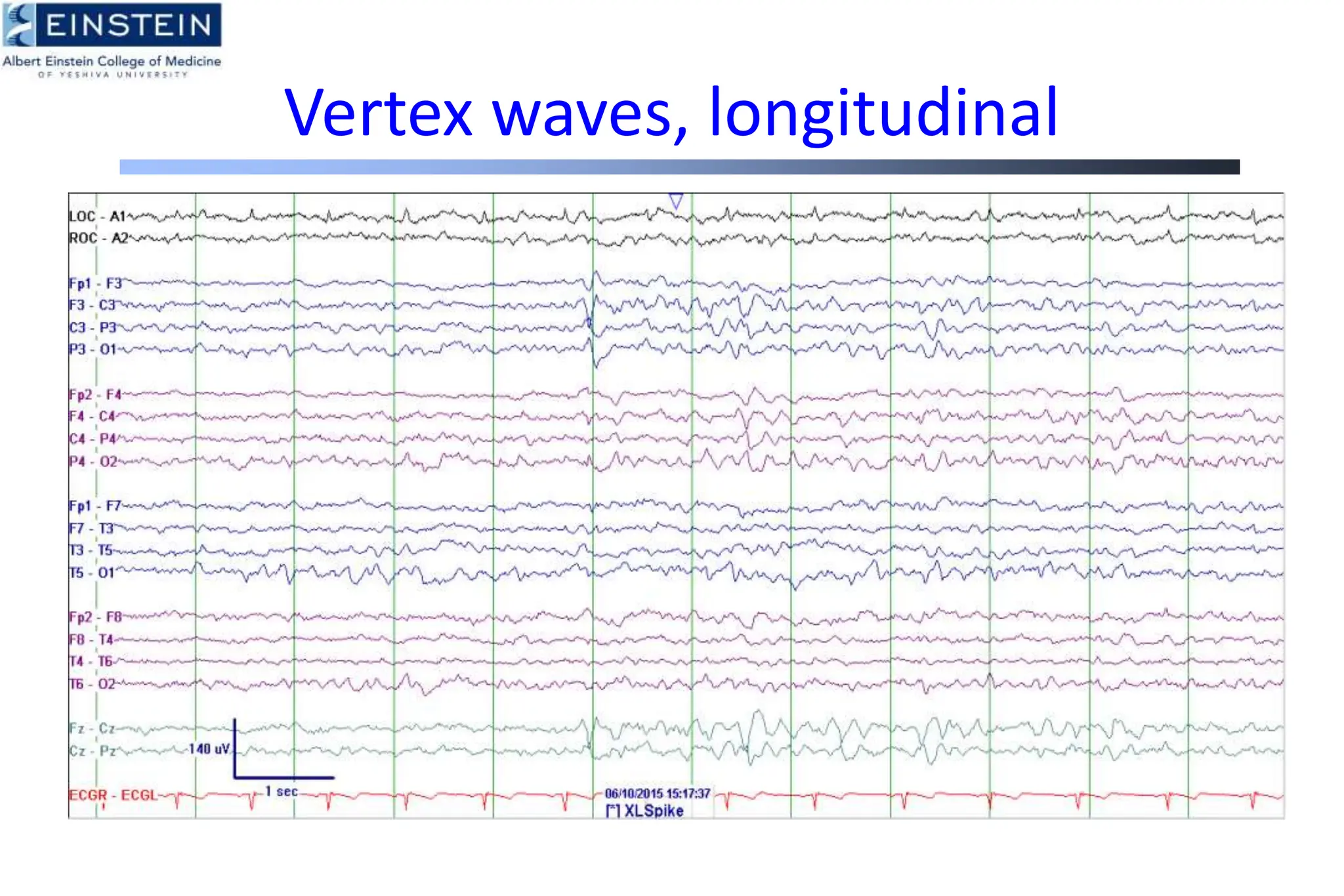 Basics of EEG - A brief review of the EEG.ppt