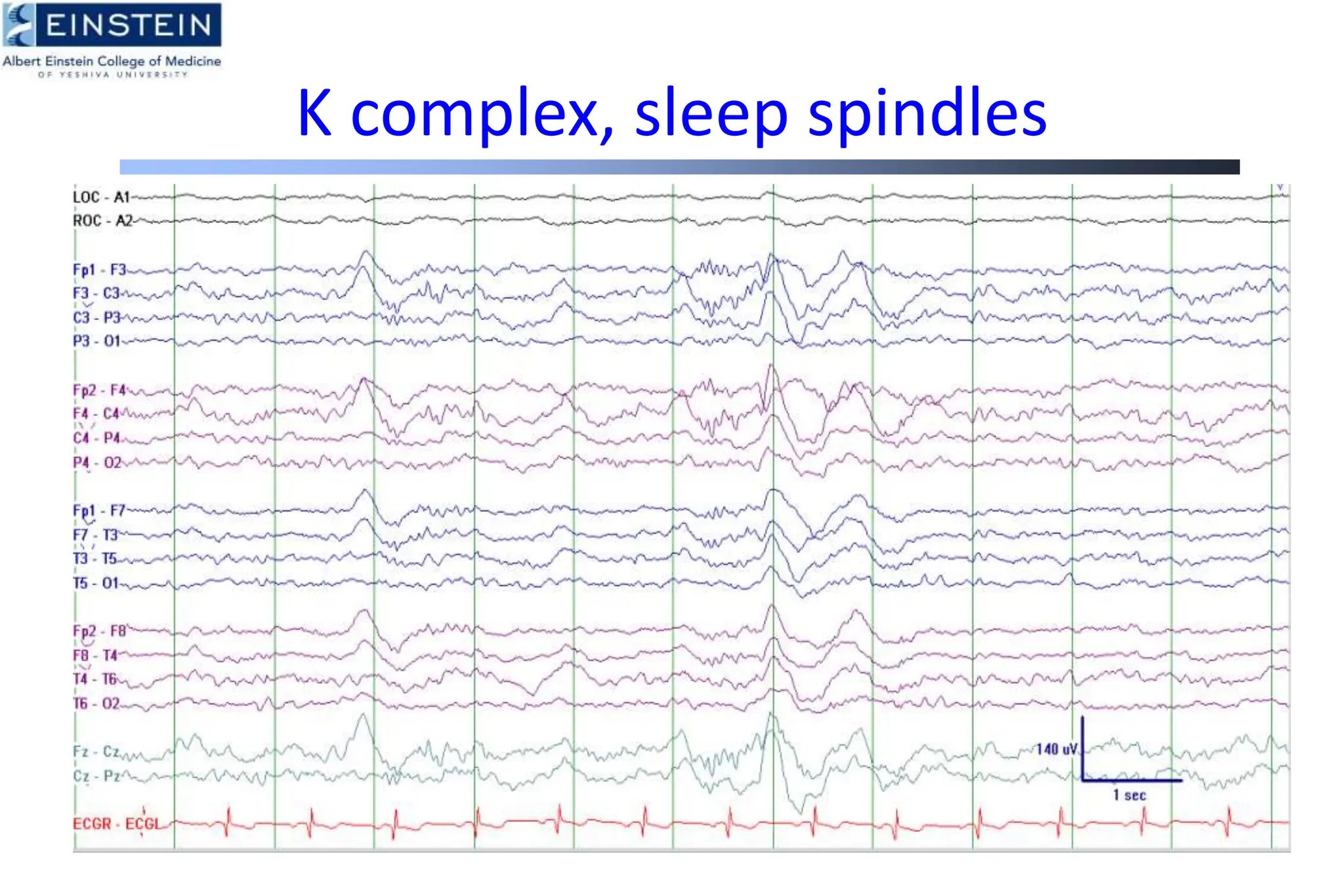 Basics of EEG - A brief review of the EEG.ppt