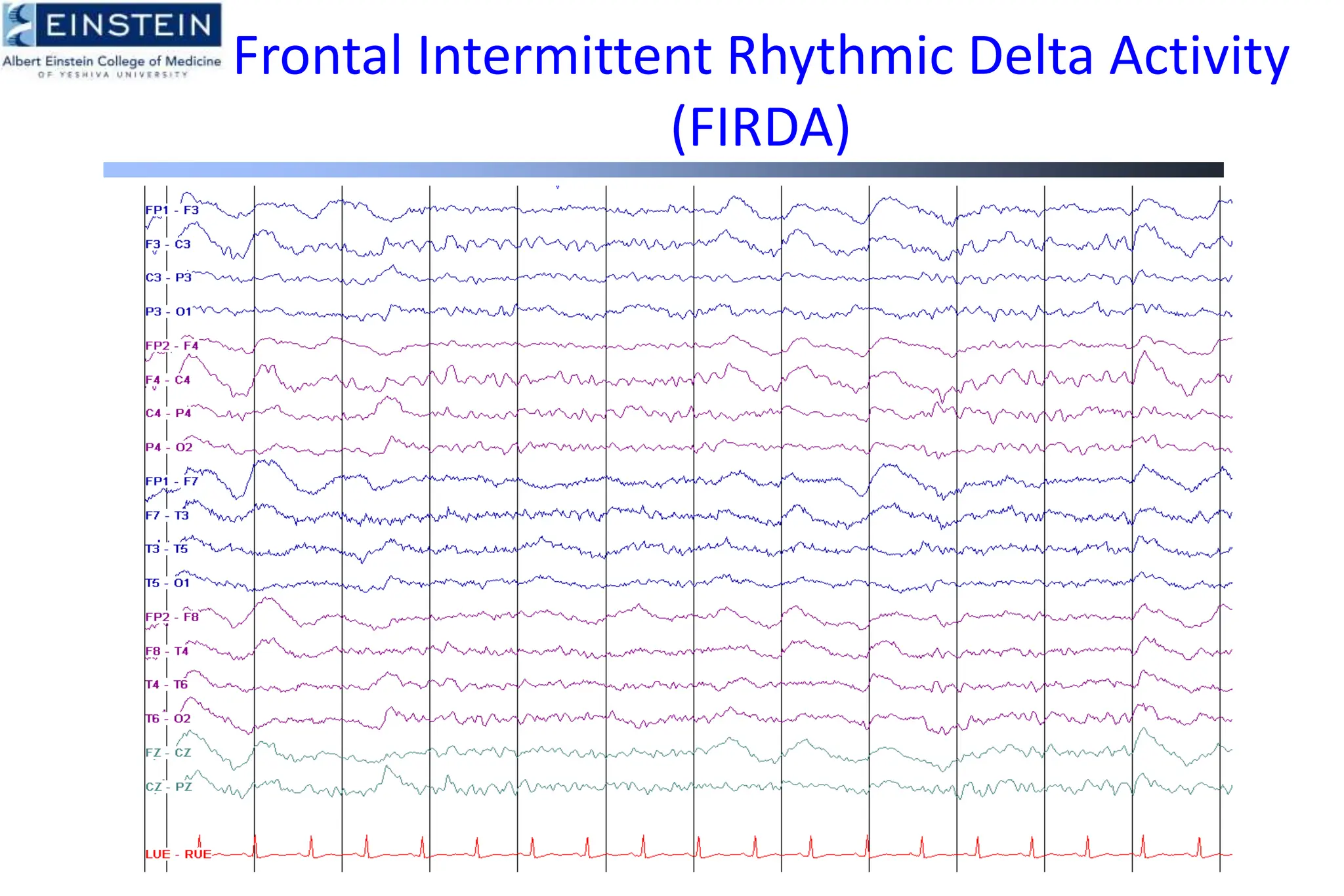 Basics of EEG - A brief review of the EEG.ppt