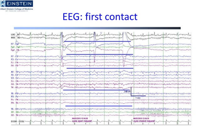 Basics of EEG - A brief review of the EEG.ppt