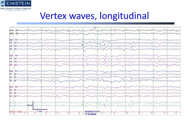 Basics of EEG - A brief review of the EEG.ppt