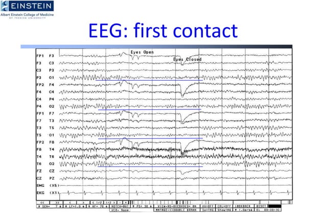 Basics of EEG - A brief review of the EEG.ppt