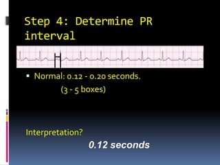 Basic ekg | PPTX