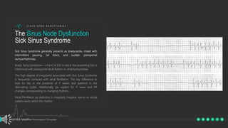 Basicekgft chapter4 ppt | PPT