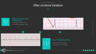 Basicekgft chapter5-6 ppt | PPT