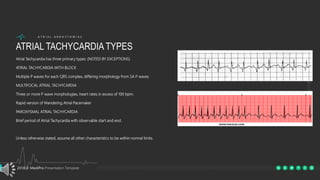 Basicekgft chapter5-6 ppt | PPT