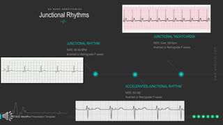 Basicekgft chapter5-6 ppt | PPT
