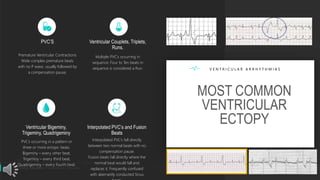 Basicekgft chapter7-8 ppt | PPT