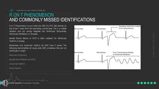 Basicekgft chapter7-8 ppt | PPT
