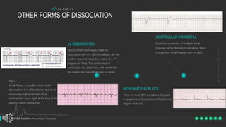 Basicekgft chapter7-8 ppt | PPT