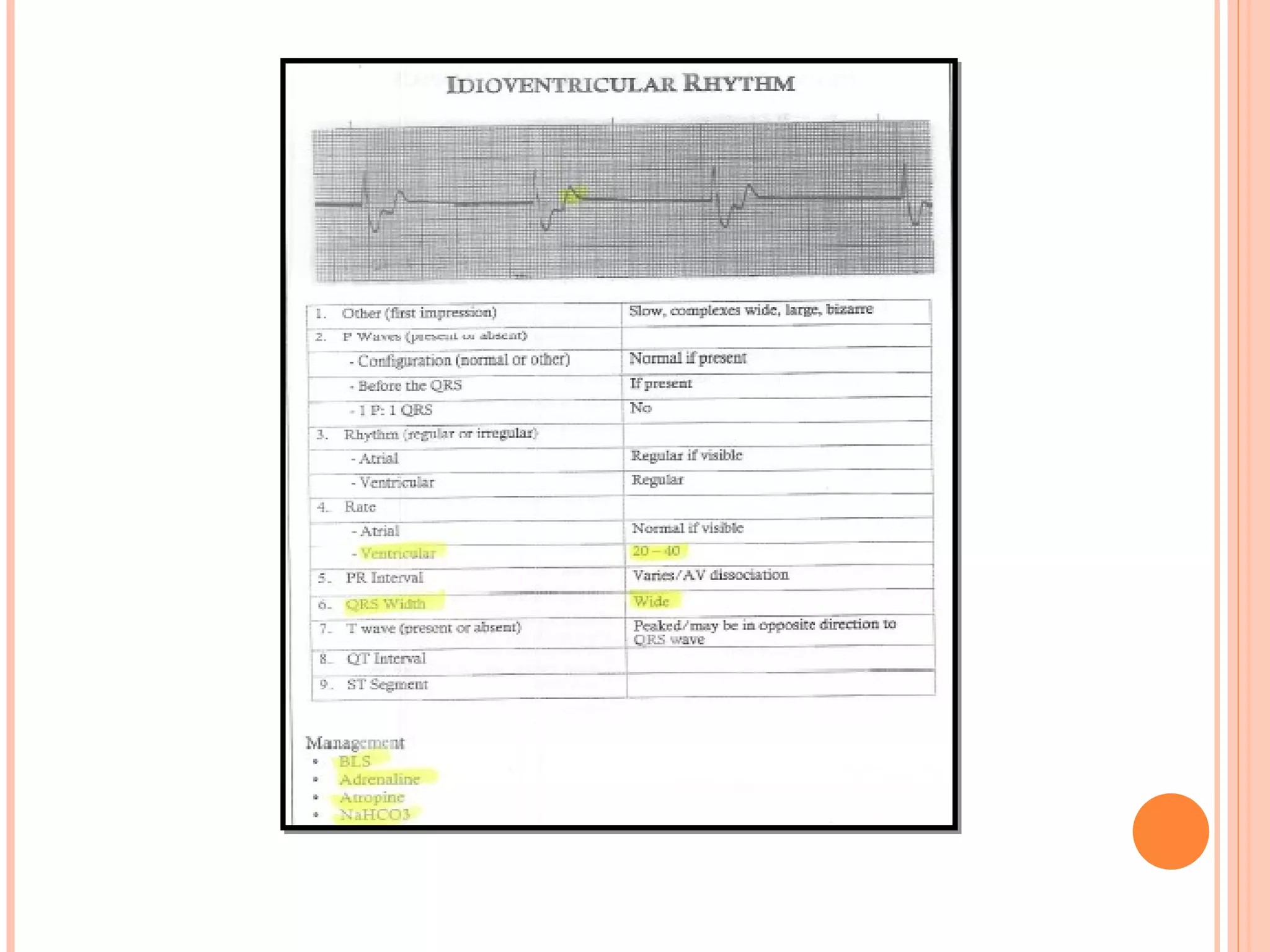 Basic EKG Interpretation | PPT