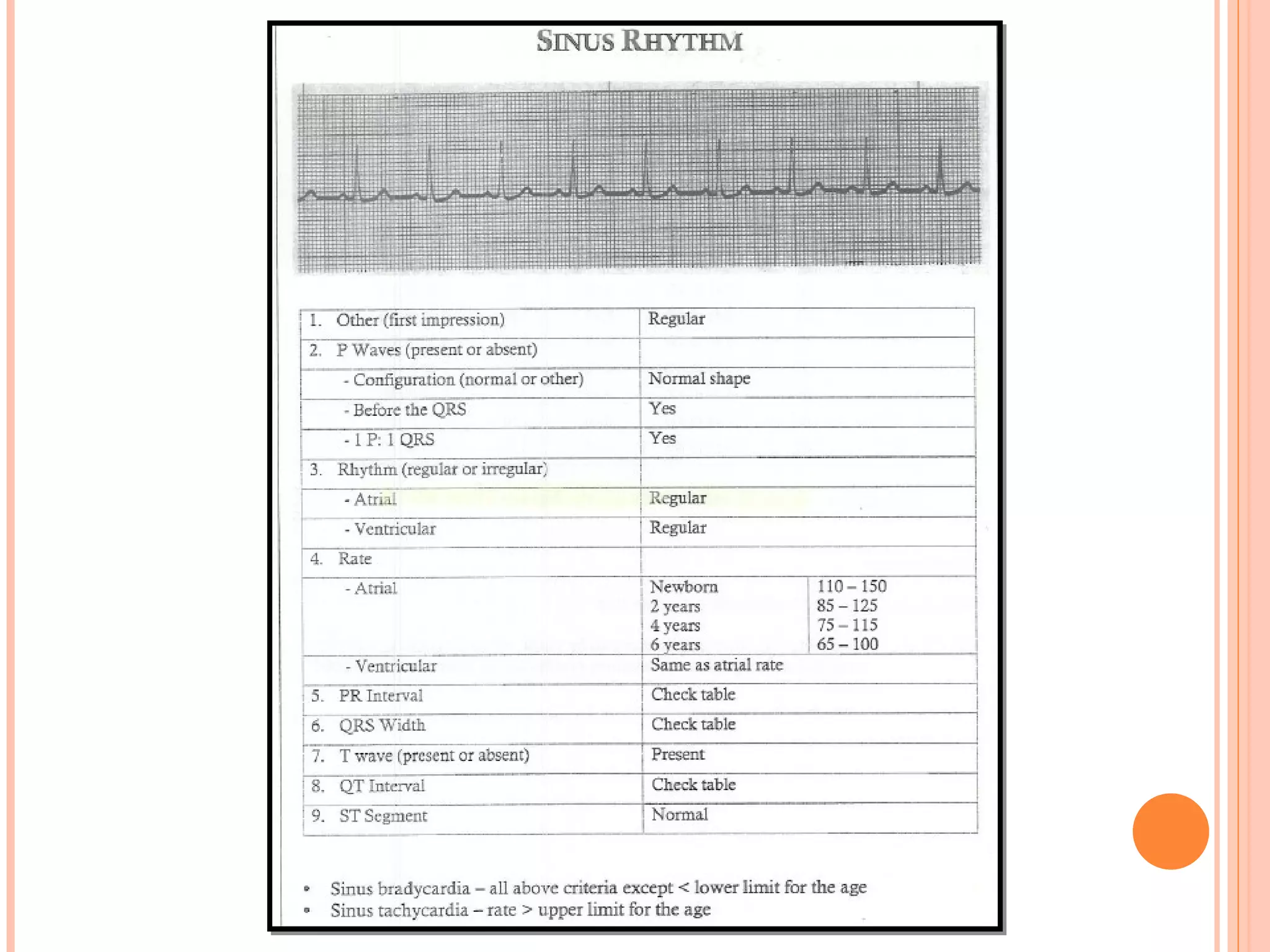 Basic EKG Interpretation | PPT