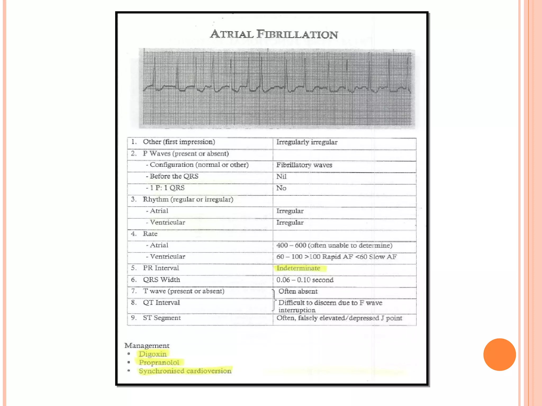 Basic EKG Interpretation | PPT