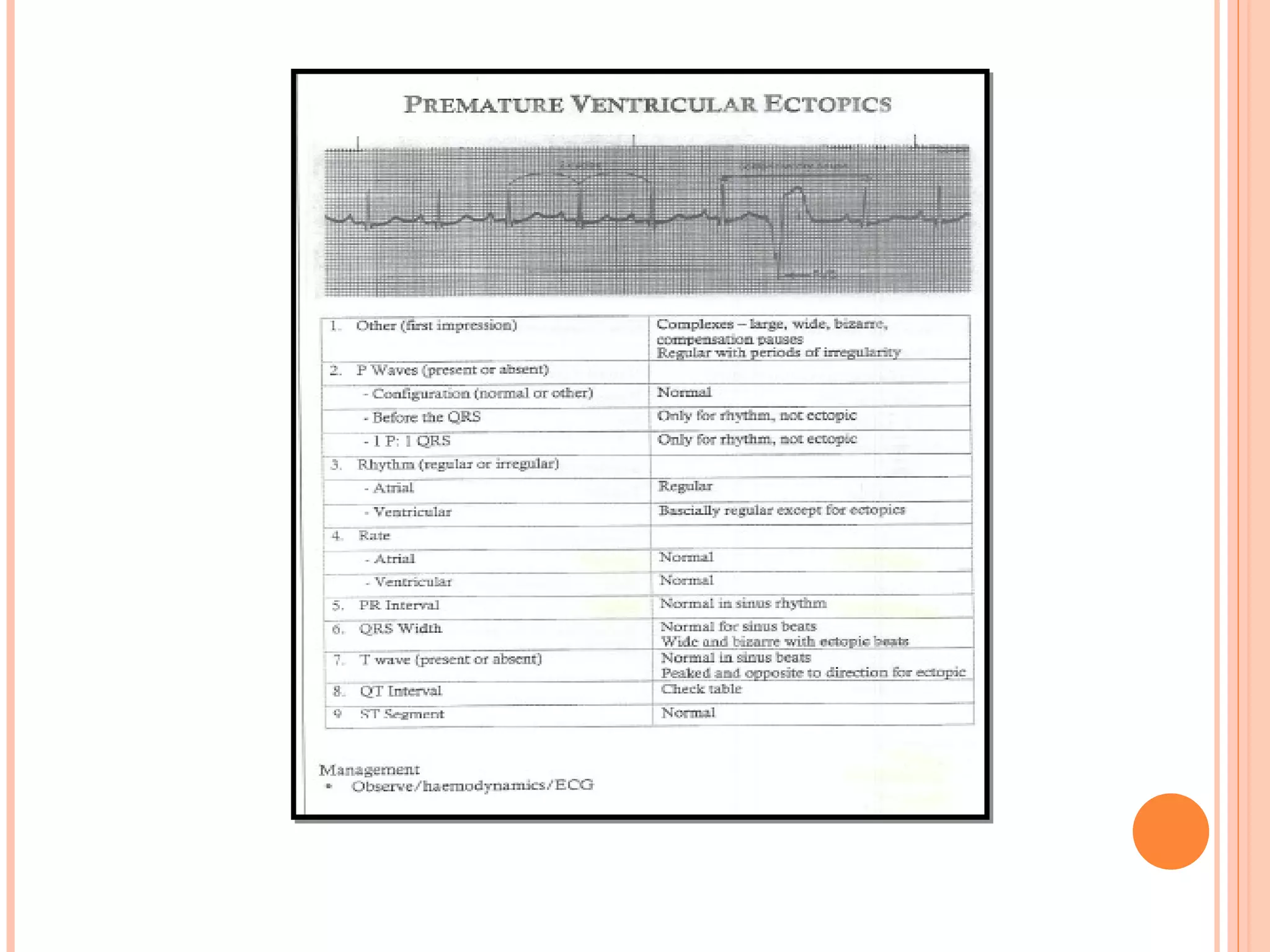 Basic EKG Interpretation | PPT