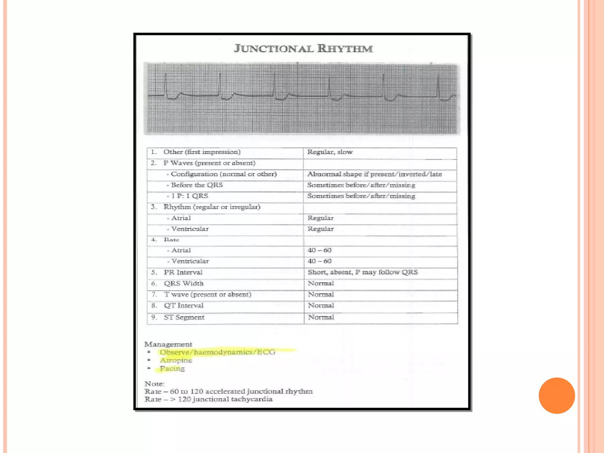 Basic EKG Interpretation | PPT