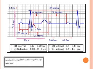 Basic EKG Interpretation | PPT