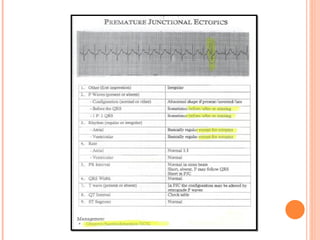Basic EKG Interpretation | PPT
