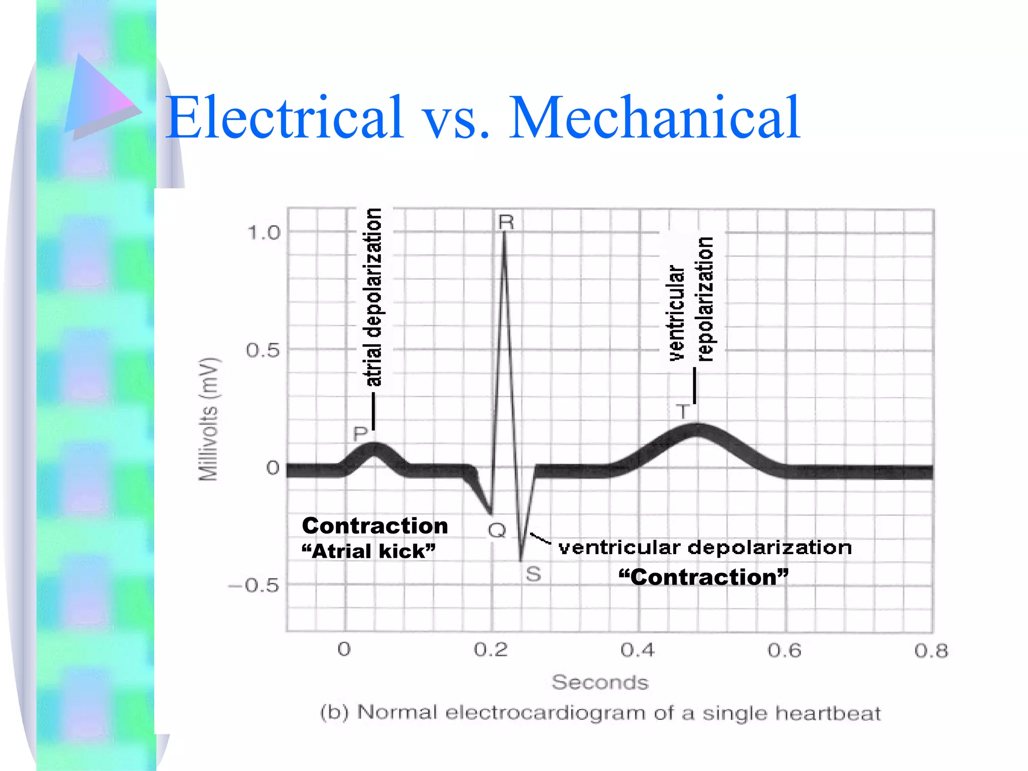 Basic Ekg Reviewr2 | PPT
