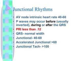 Basic Ekg Reviewr2 | PPT
