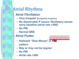 Basic Ekg Reviewr2 | PPT