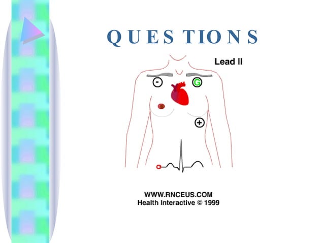 Basic Ekg Reviewr2 | PPT | Heart and Cardiovascular Diseases | Diseases and Conditions