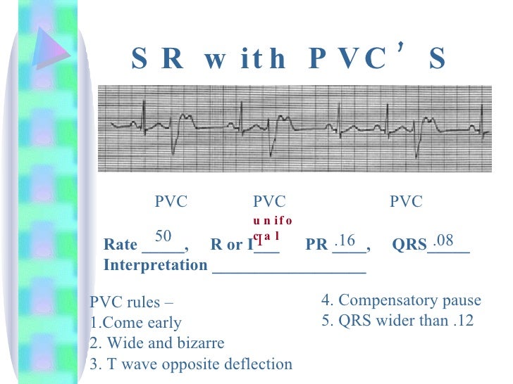 Basic Ekg Reviewr2