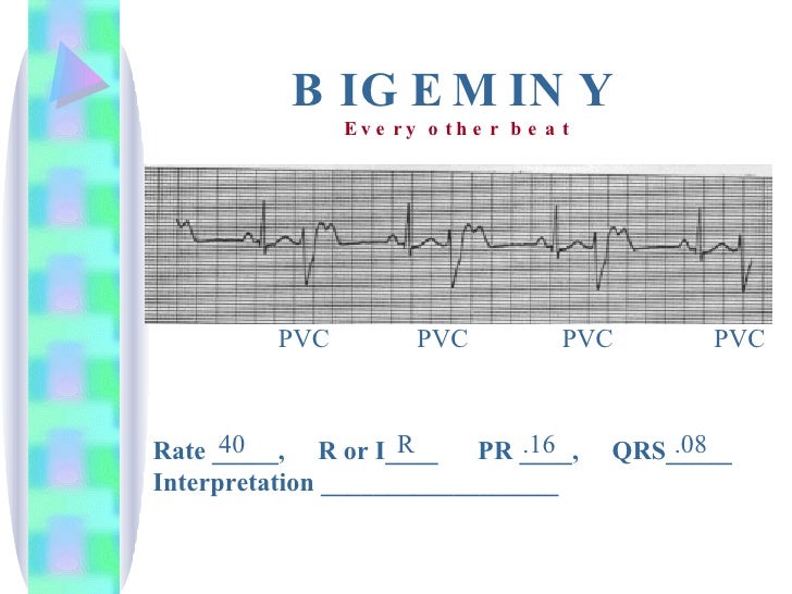 Basic Ekg Reviewr2