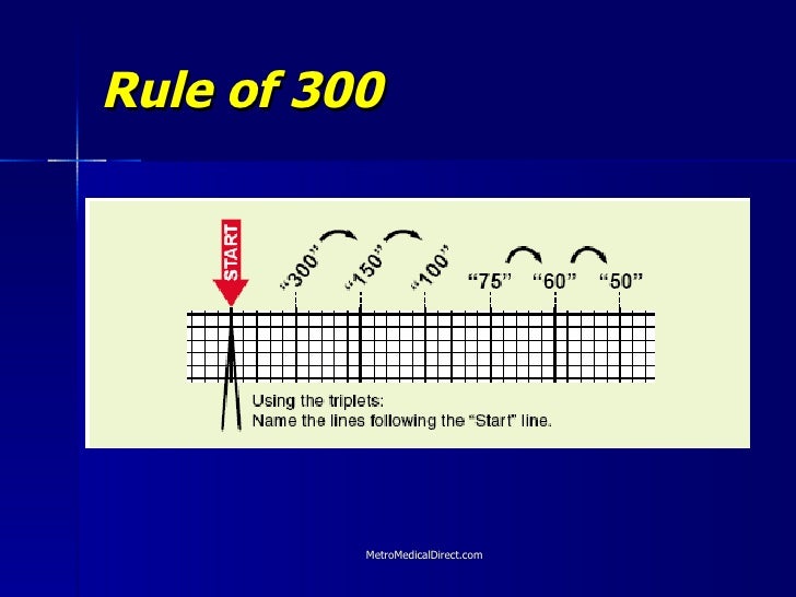 Basic EKG Basic EKG
