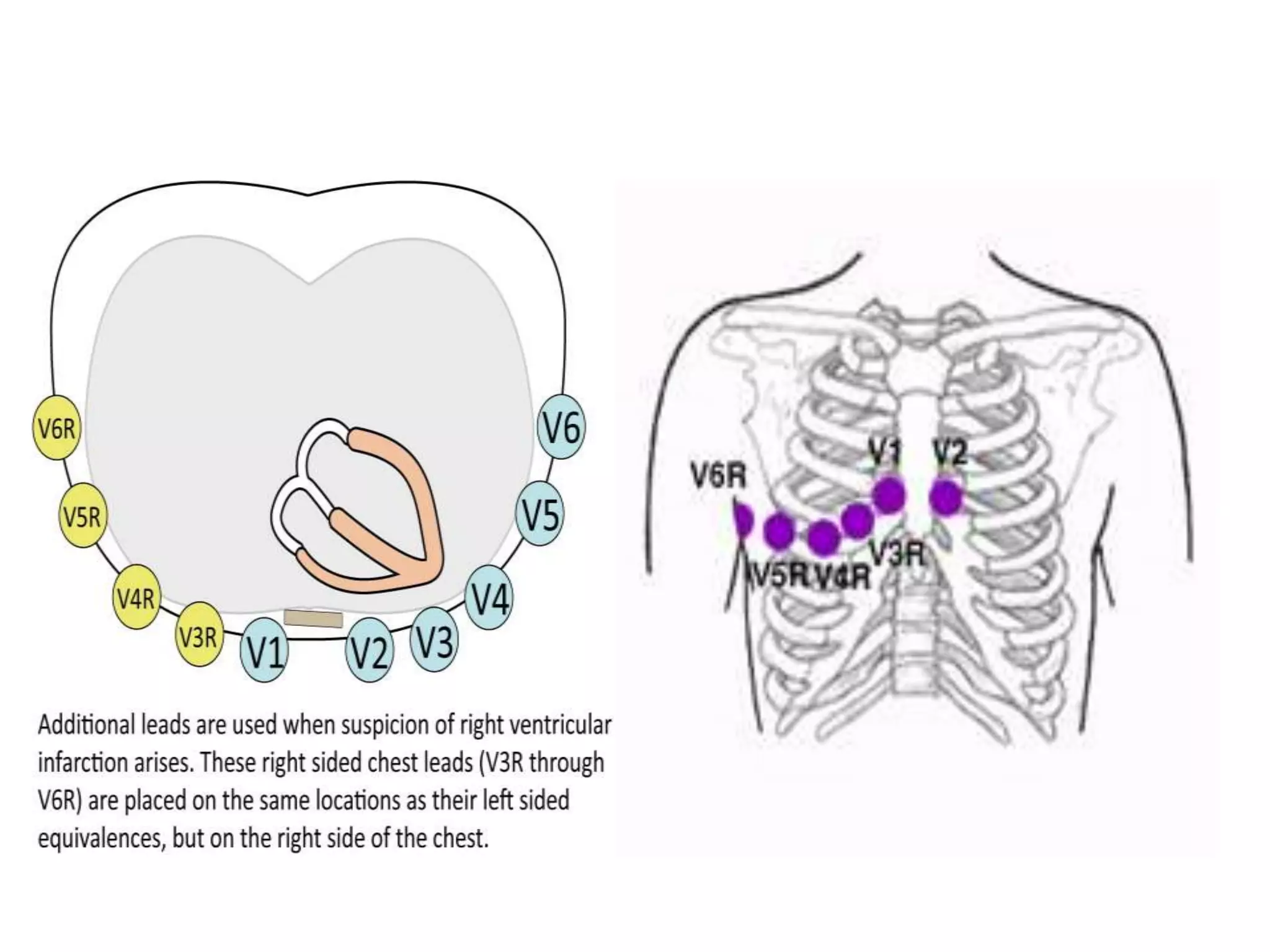 Basic electrocardiography and Beyond | PPT
