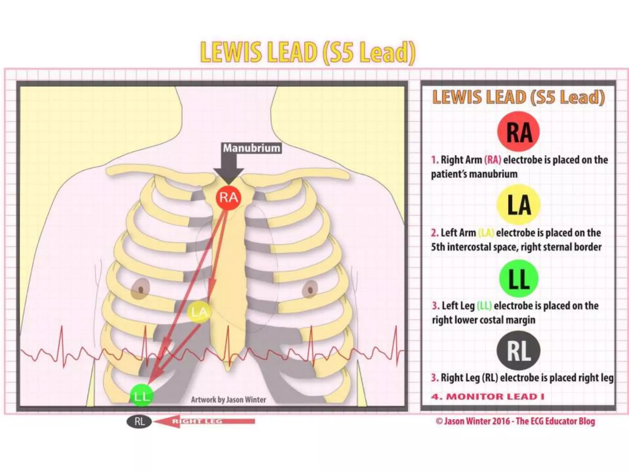 Basic electrocardiography and Beyond | PPT